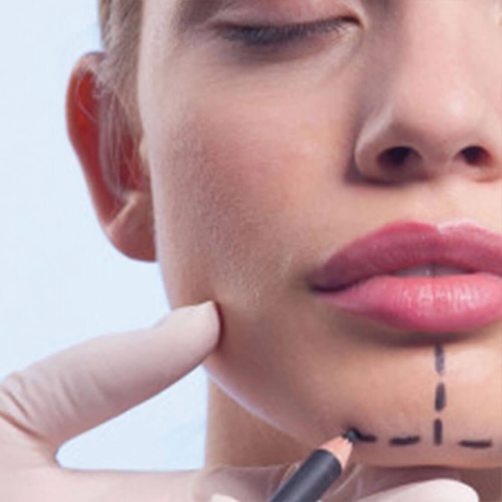 Esthetic Chin Surgery - Istanbul - Turkey - Ibrahim Ercan, MD